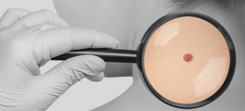 Dermamedizin – dermatologie